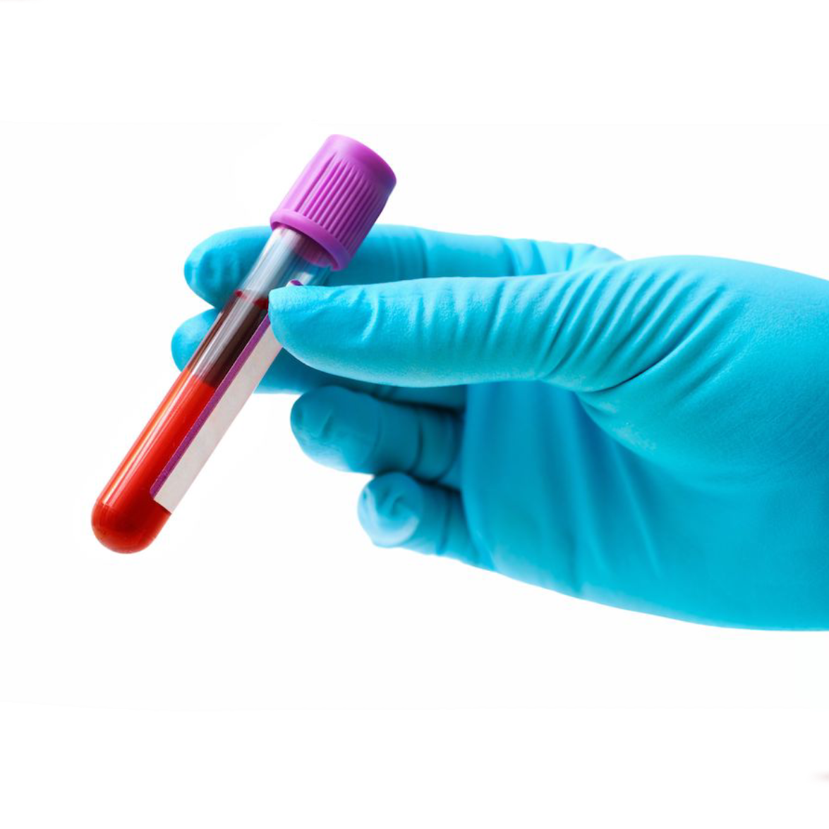 Online laboratory tests - Protect your well -being | Myfloridalab – MY ...