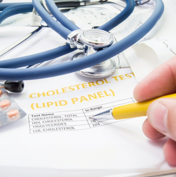 303756- Cholesterol and Total Lipid Panel – MY FLORIDA LAB