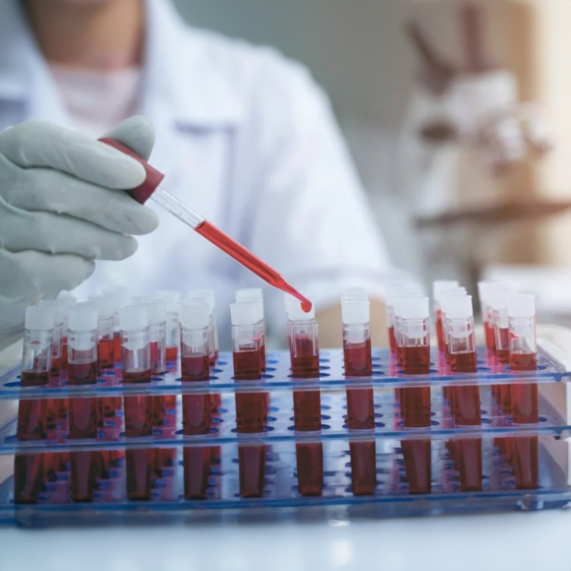 Online laboratory tests - Protect your well -being | Myfloridalab – MY ...