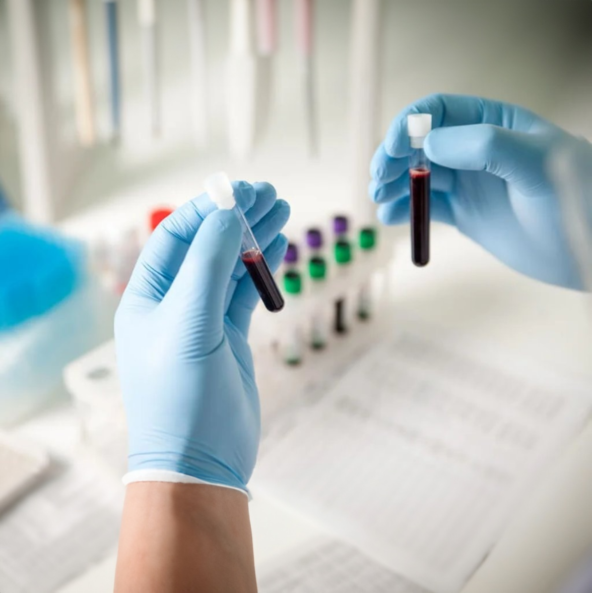 Online laboratory tests - Protect your well -being | Myfloridalab – MY ...