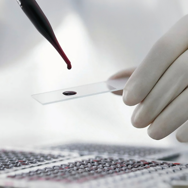 144000- Acute Hepatitis Panel – MY FLORIDA LAB