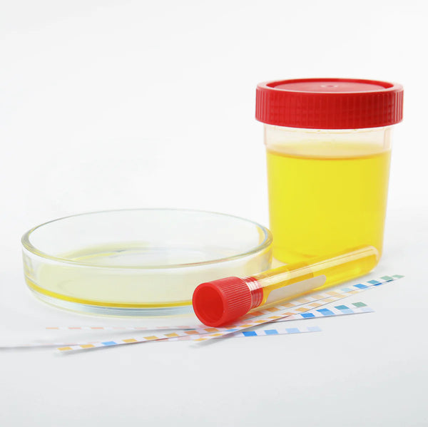 008847-Urine Culture – MY FLORIDA LAB